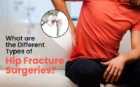 What are the Different Types of Hip Fracture Surgeries?
